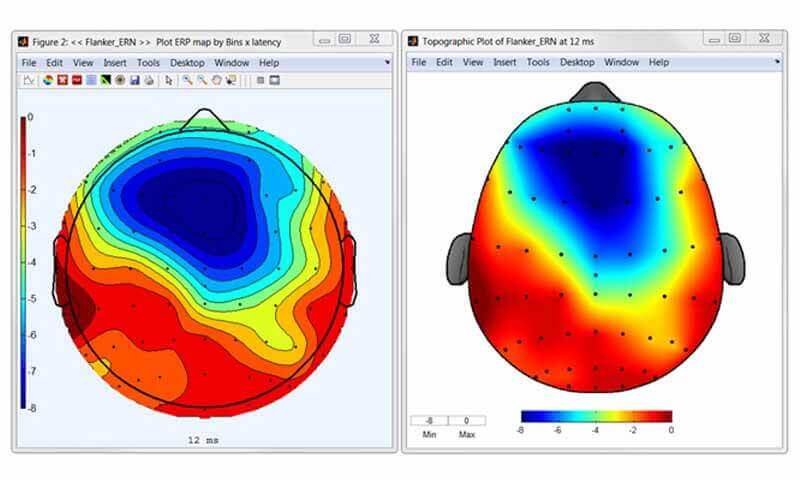 EEGLAB - آکادمی آنلاین مهندسی پزشکی و هوش مصنوعی