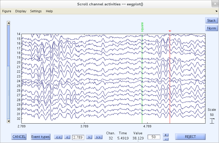 کار با صفحه eegplot در EEGLAB - آکادمی آنلاین مهندسی پزشکی و هوش مصنوعی