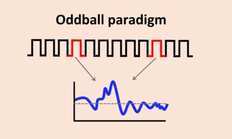 پارادایم عجیب و غریب -Oddball paradigm - آکادمی آنلاین مهندسی پزشکی و ...