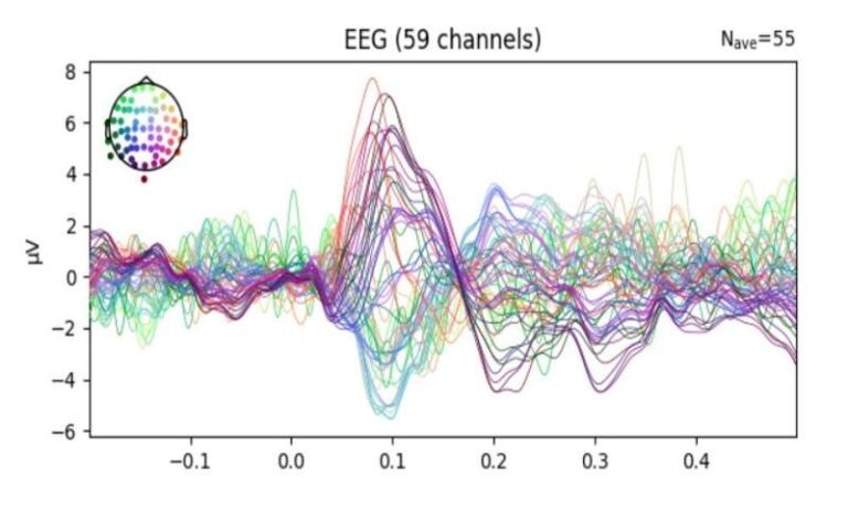 نحوه ی نصب و راه اندازی پکیج MNE پایتون - آکادمی آنلاین مهندسی پزشکی و ...