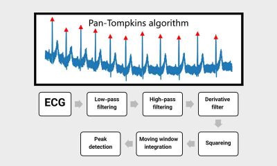 الگوریتم Pan-Tompkins در تشخیص پیکهای R سیگنال ECG - آکادمی آنلاین ...